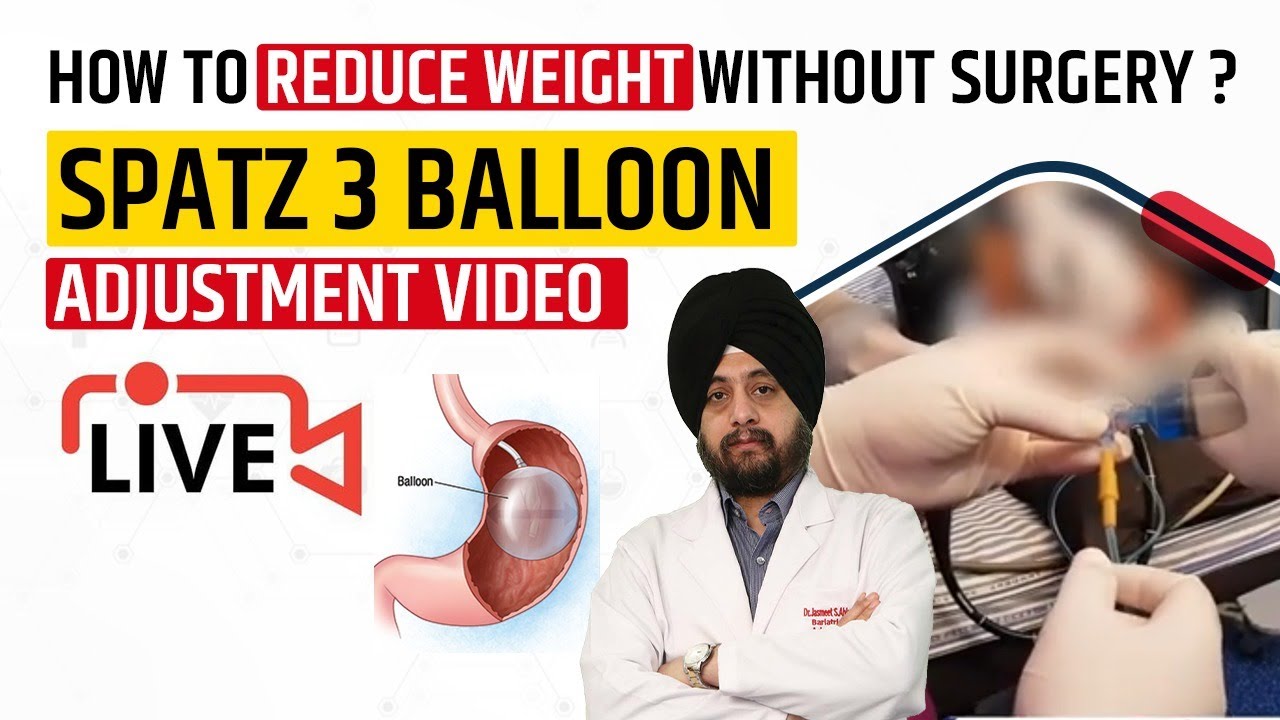 Spatz 3 Balloon Adjustment Video | Orb-era Balloon | How To Reduce ...