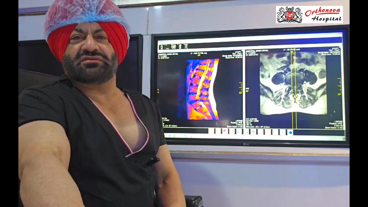 Difficult Endoscopic Spine Surgery | Dr. Harprit Singh | Patient Walk ...