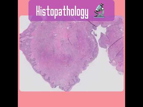 Cat Eosinophilic Granuloma Complex - YouTube
