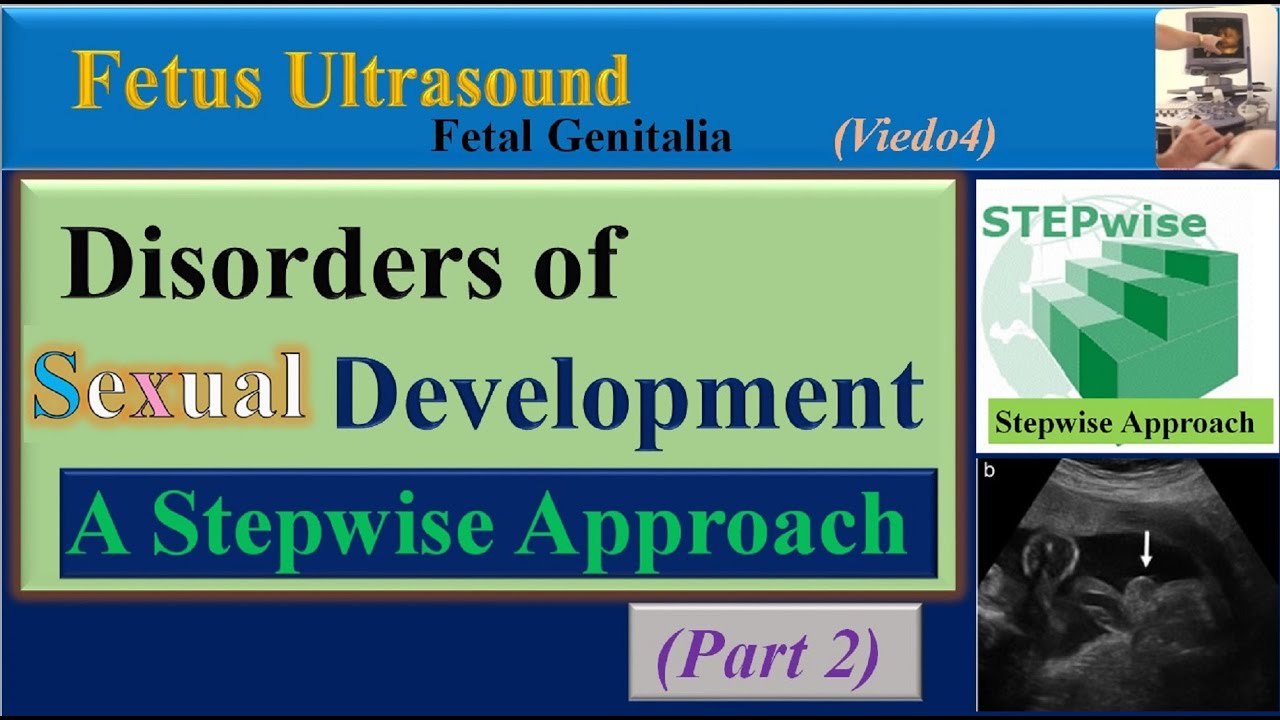 Fetus Ultrasound, Disorders of Sexual Development Part2 - YouTube