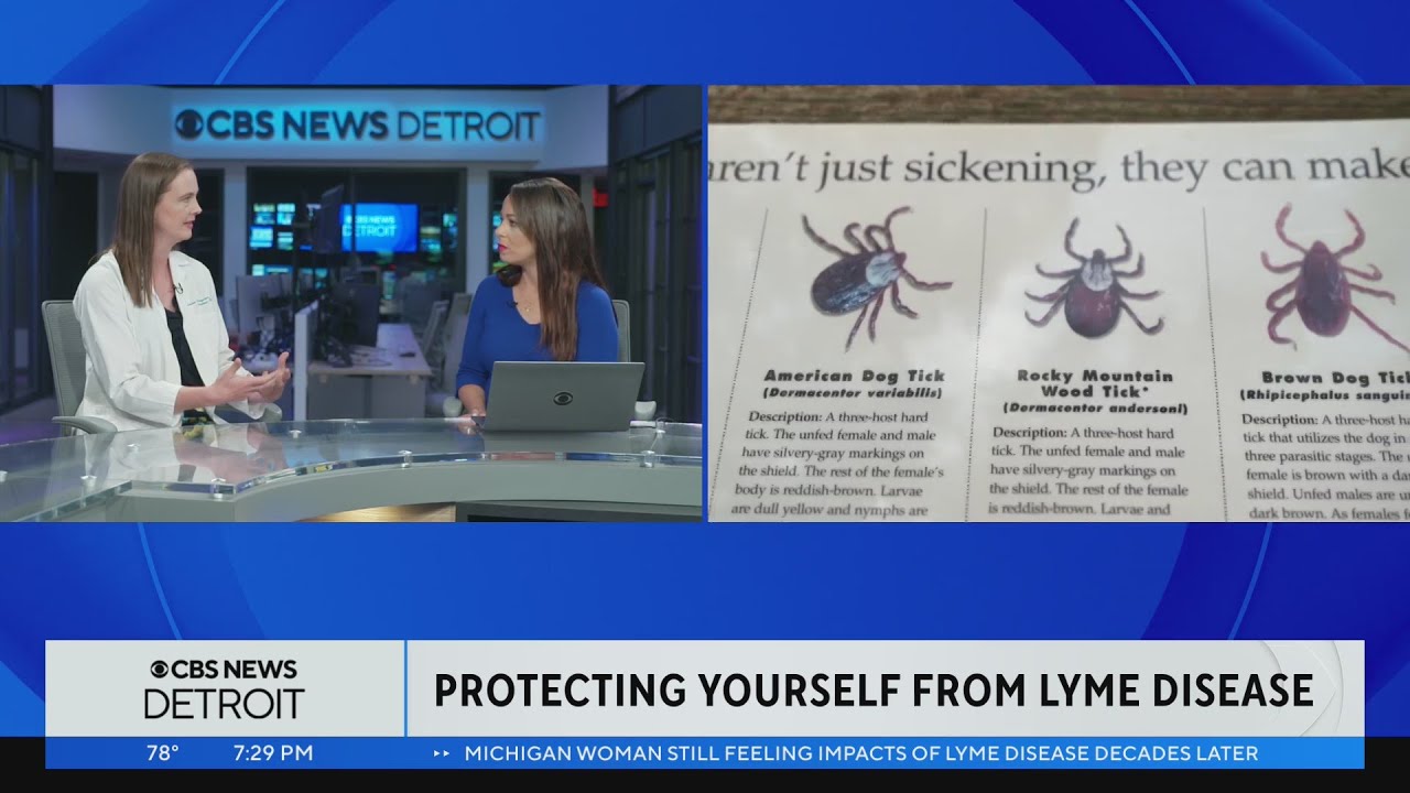 Health expert discusses how to stay safe during tick season - YouTube