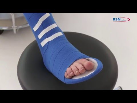 Reinforced Posterior Leg Splint EN - YouTube