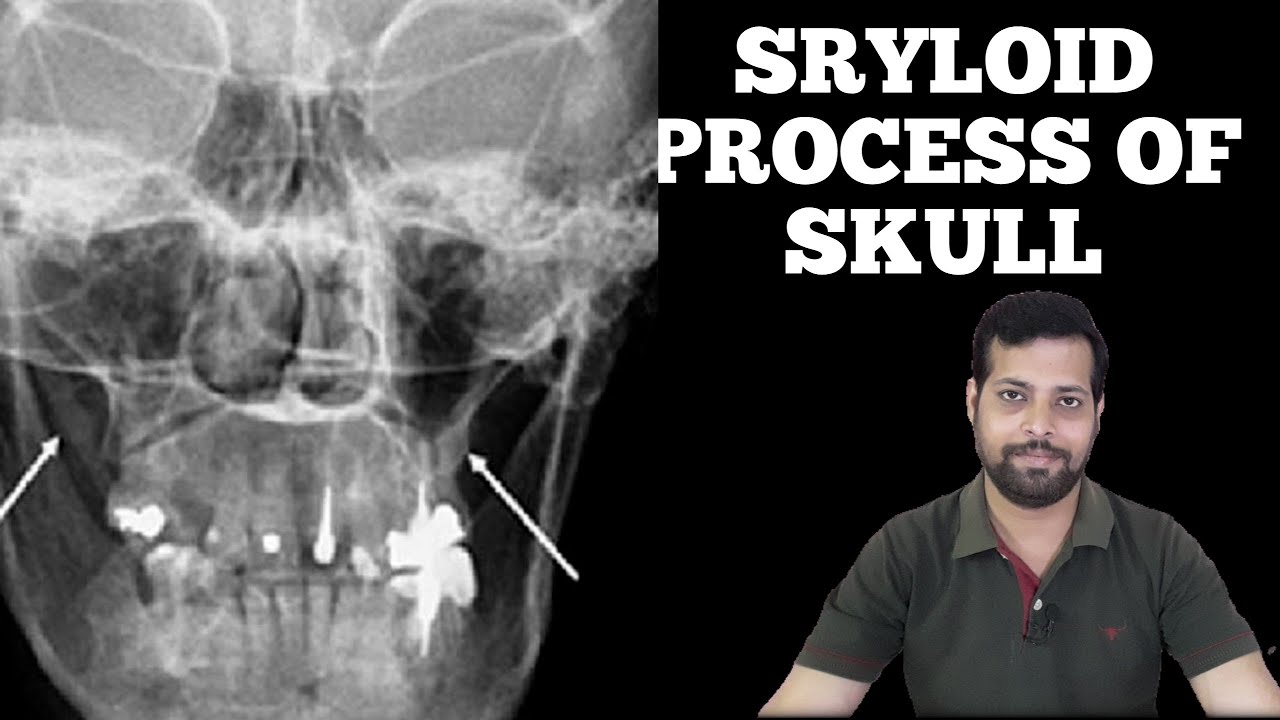 STYLOID PROCESS OF SKULL PA, TOWN'S AND LAT - YouTube