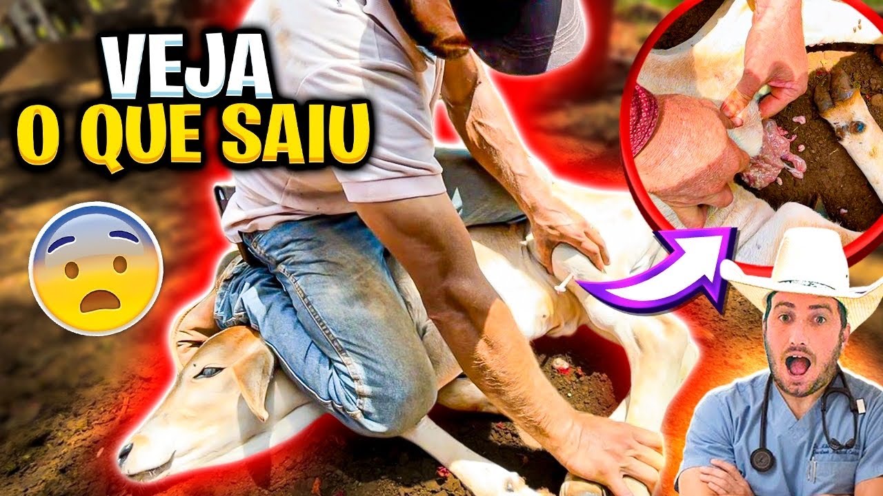 VEJA O QUE SAI DA PERNA QUEBRADA - YouTube