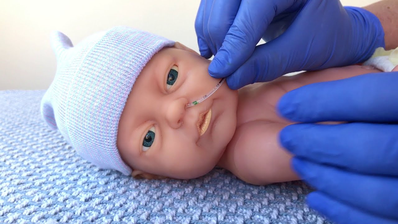 Inbrengen van een neus-maagsonde bij een neonaat - YouTube