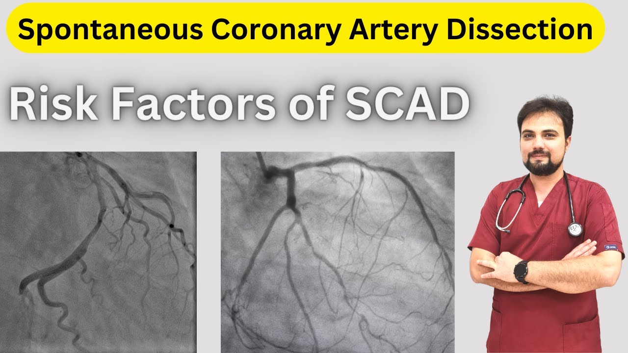 Spontaneous Coronary Artery Dissection-Risk Factors - YouTube