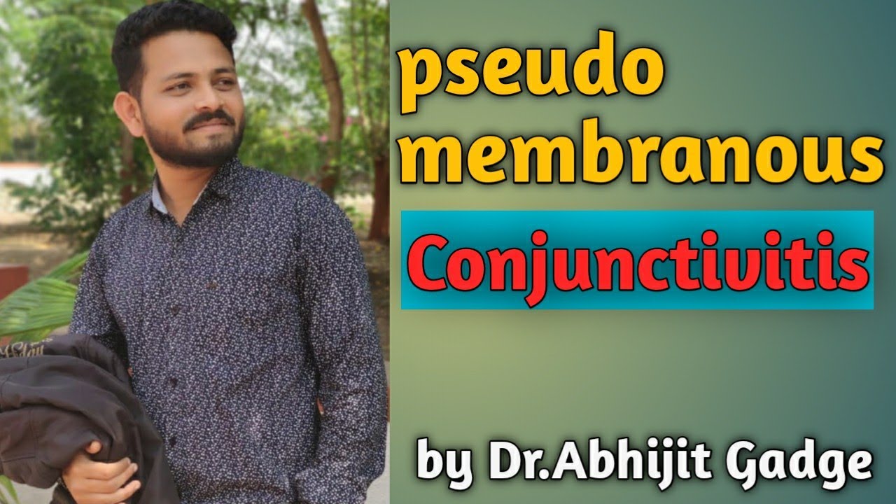 Pseudomembranous conjunctivitis - YouTube