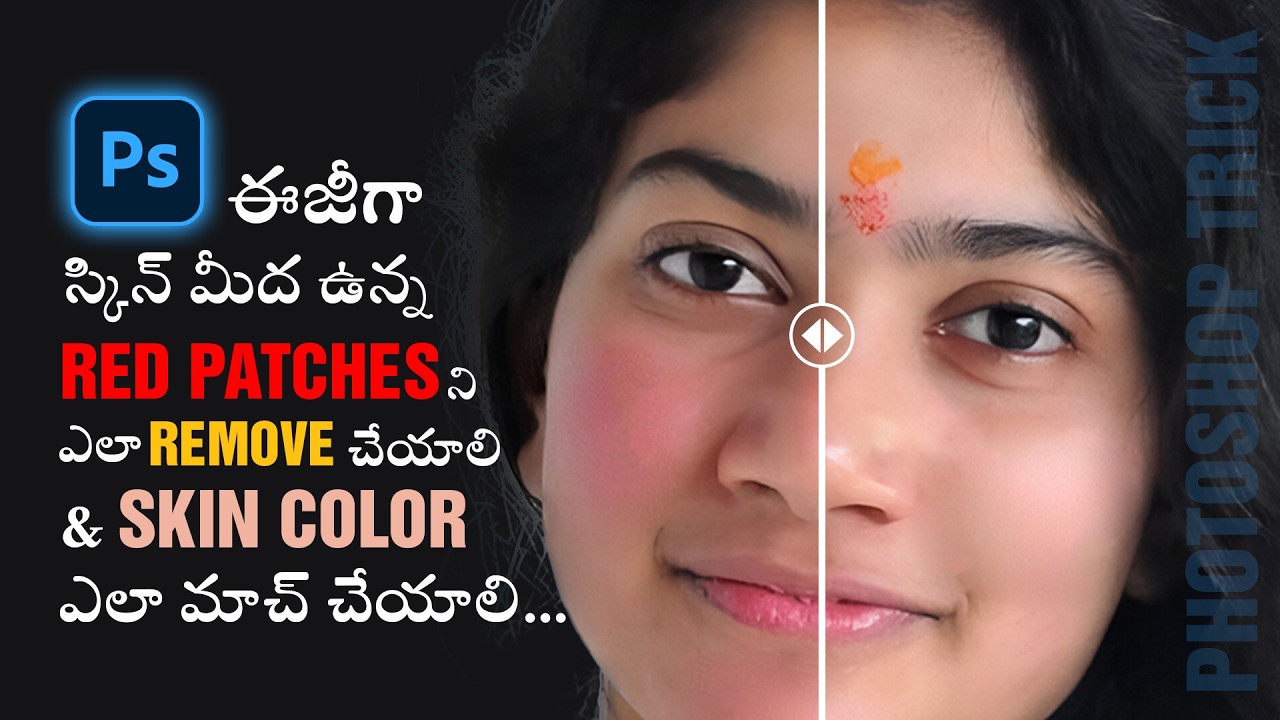 Photoshop Trick: Remove Red Patches Like a Pro! | Skin Color Matching ...