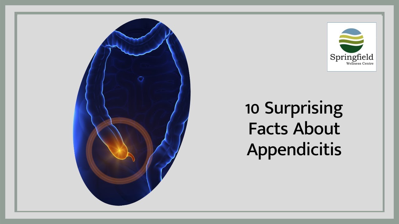 10 Surprising Facts About Appendix | Dr Maran on Appendicitis - YouTube