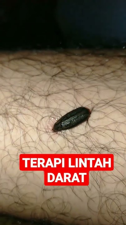 Pengalaman pertama sa,at TERAPI LINTAH DARAT #terapilintah - YouTube