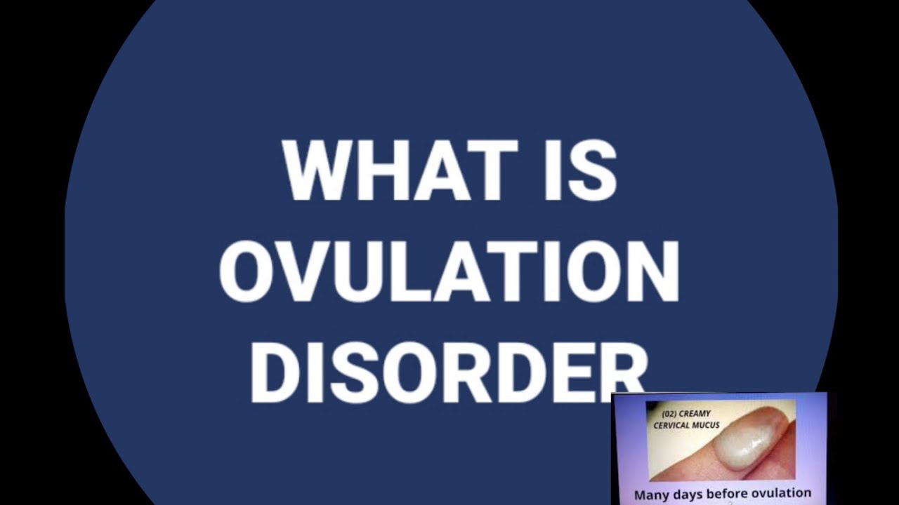 OVULATION DISORDERS/OVULATION PROBLEMS/CAUSES OF OVULATION DISORDERS ...