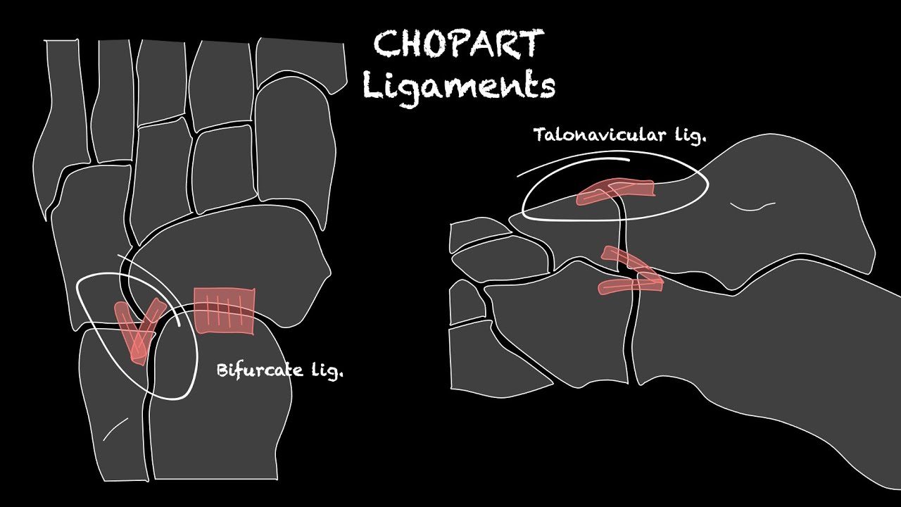 Ultrasound assessment of the Chopart ligaments - YouTube