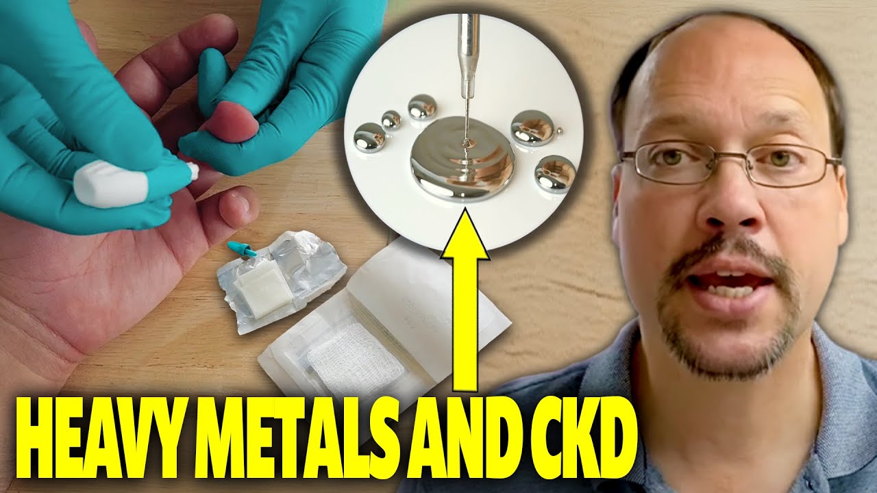 Heavy Metals, Mercury, Aluminum and Kidney Disease: Should You Get ...
