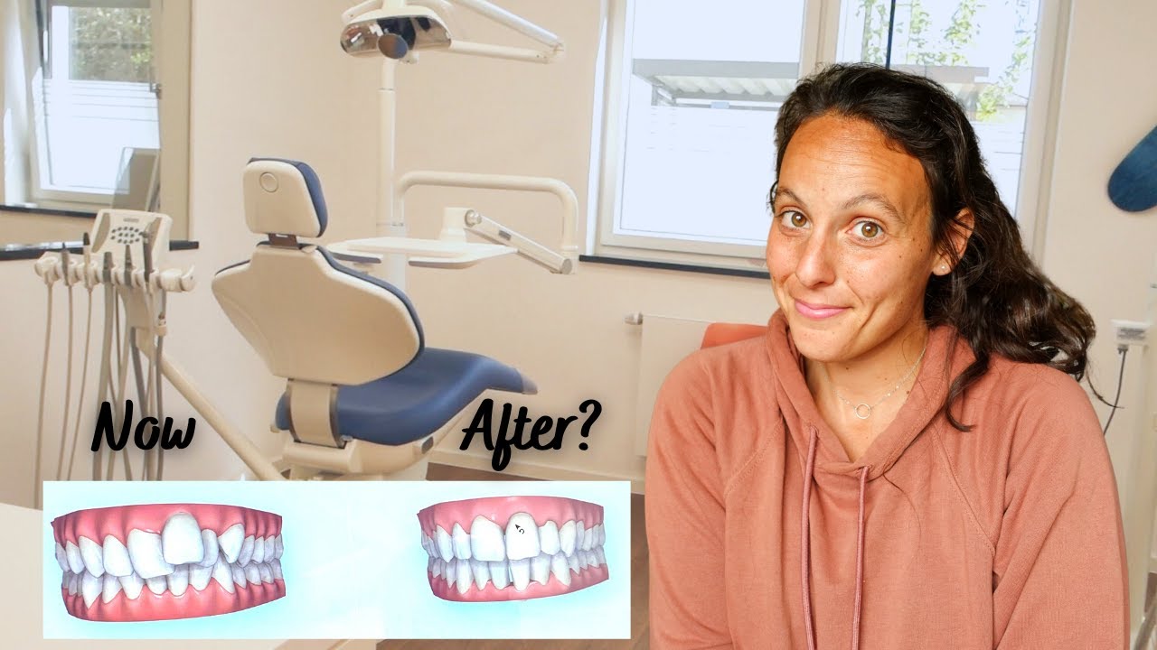 Finally Getting Braces? - YouTube