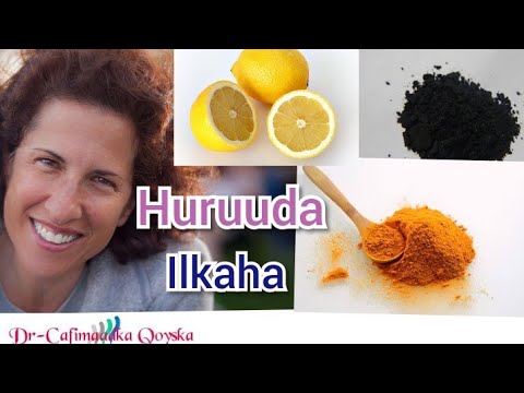 Cirid Xanuunka, Huruuda, Cadaynta Iyo Qurxinta Ilkaha - YouTube