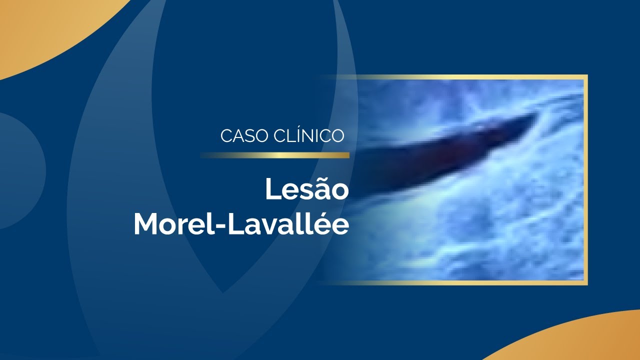 Lesão De Morel-lavallée Tratamento Fisioterapia - RETOEDU