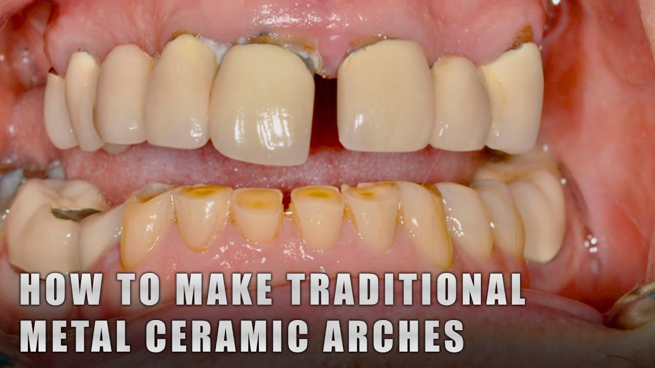 How to Make Traditional Metal Ceramic Arches - YouTube