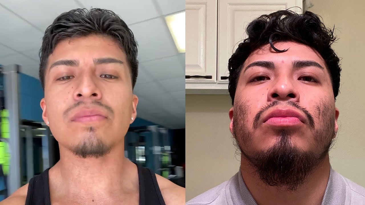 Neck Training Completely Changed My Aesthetics (Neck Transformation) # ...