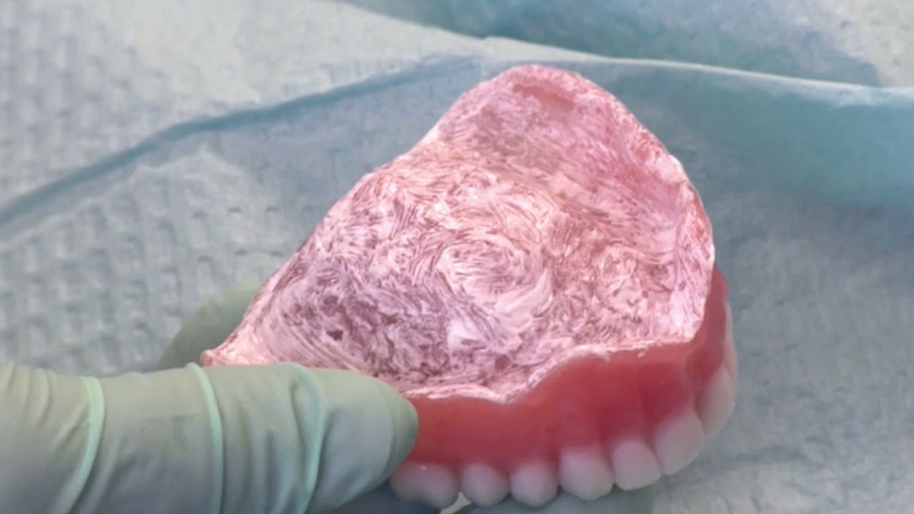 DENTCA Impressions Step 6 - Final Delivery Appointment - YouTube