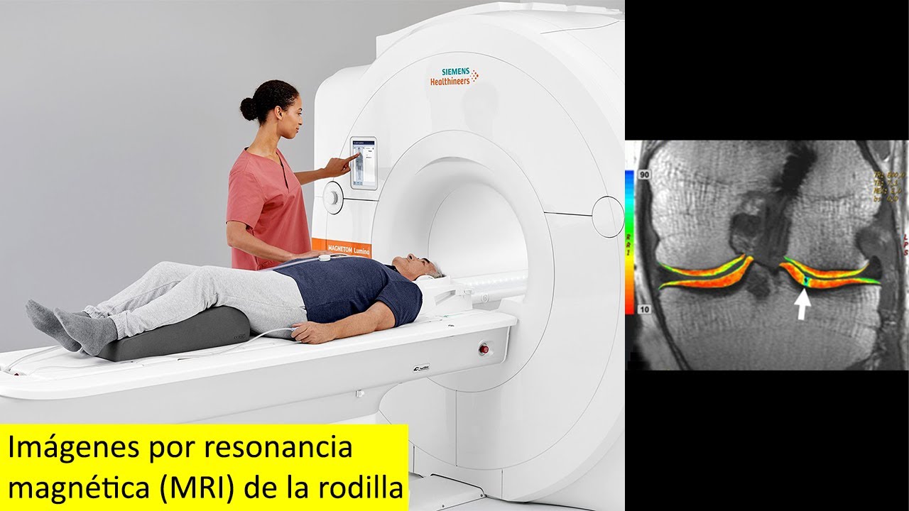 Imágenes por resonancia magnética MRI de la rodilla - YouTube