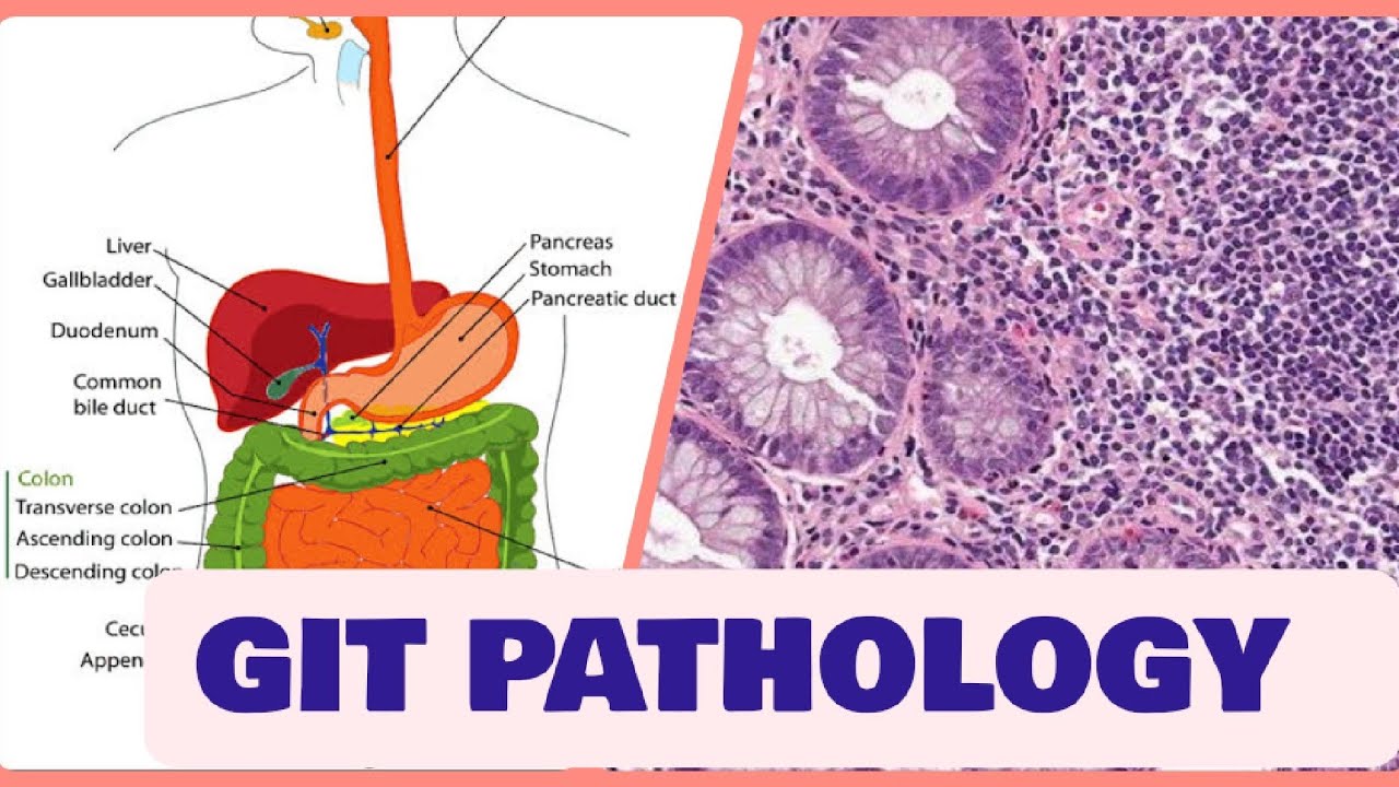 GIT pathology | Esophagus diseases | part 7 - YouTube