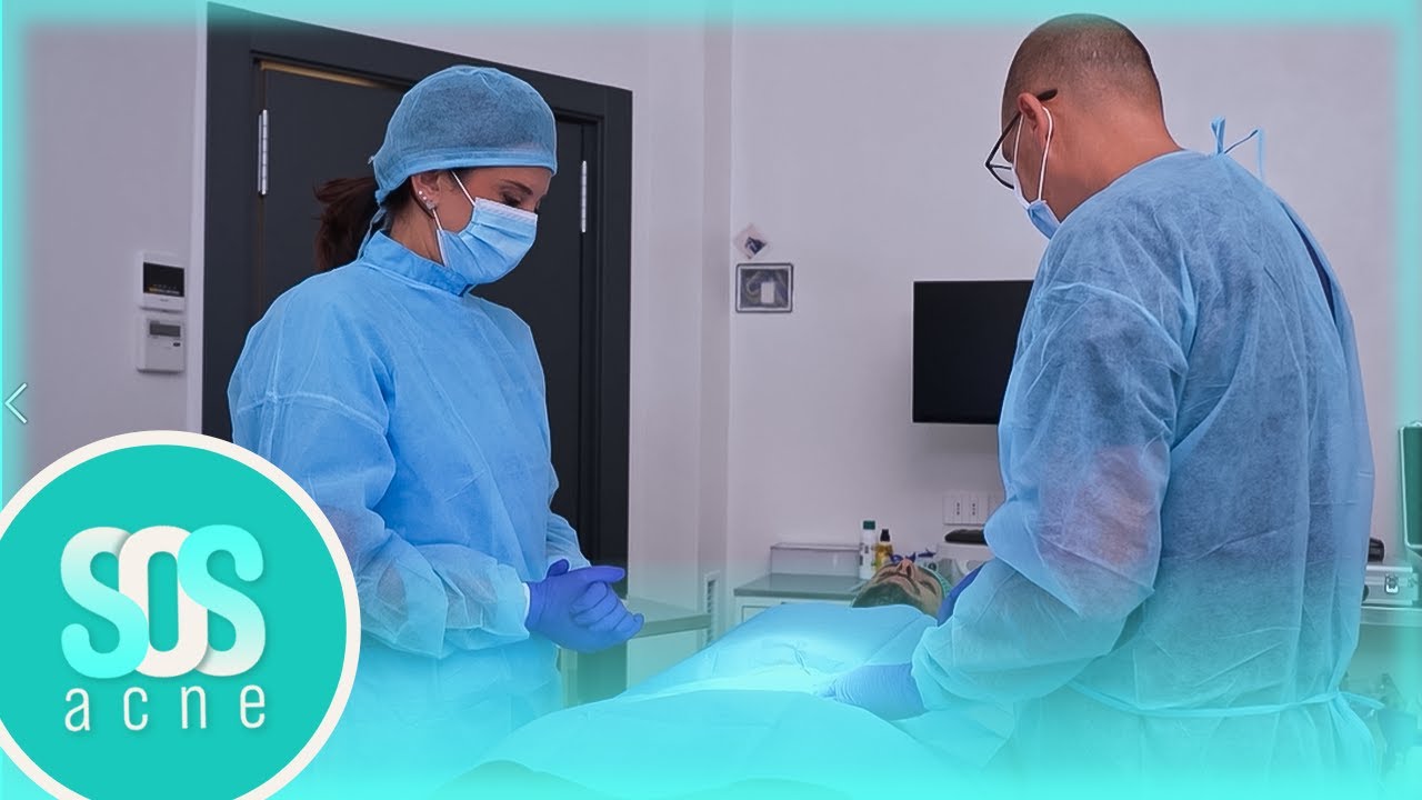Simone controlla un brutto neo sull'addome | Sos Acne - YouTube
