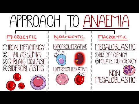 Anaemia Made Easy (An Approach to Anaemia)