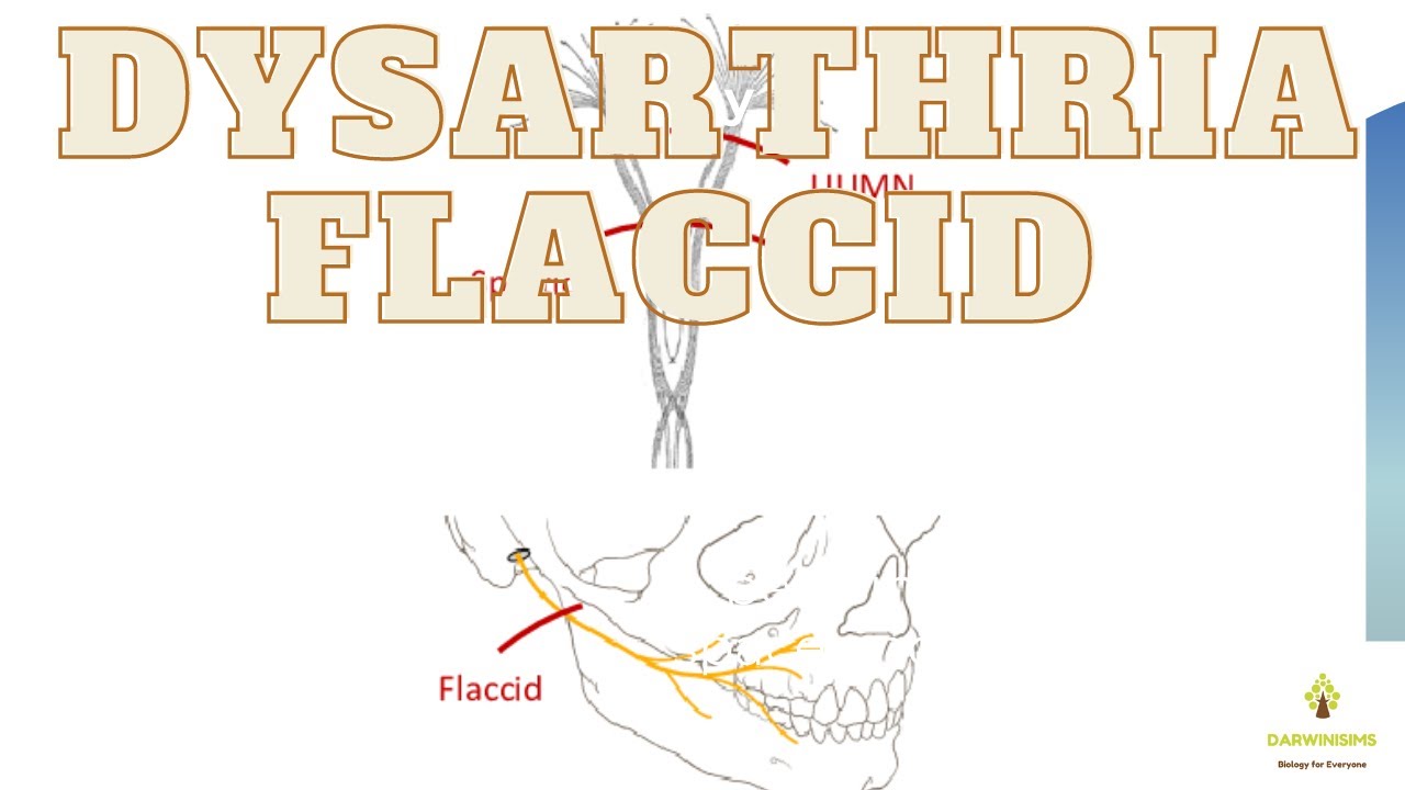Flaccid Dysarthria, - flaccid dysarthria characteristics, flaccid ...