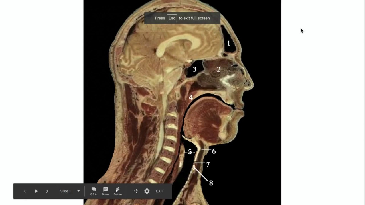 The Anatomy of Obstructive Sleep Apnea - YouTube