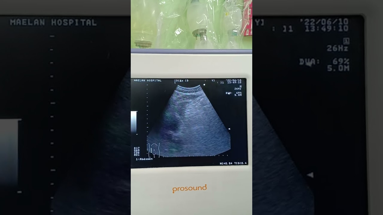 สมัครเรียนE-FAST scan ของลักษมี - YouTube