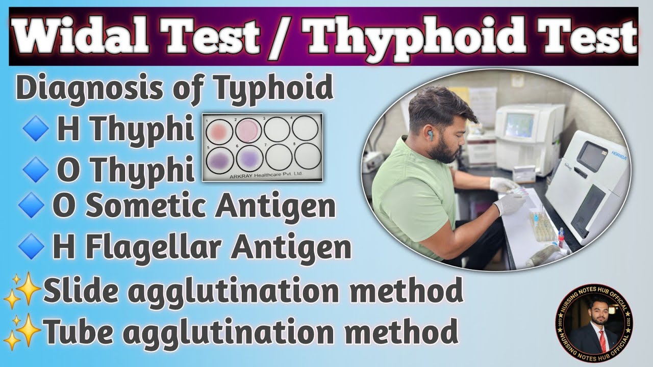 Widal test/ Typhoid Test |Typhoid Test in Lab Practical|microbiology ...