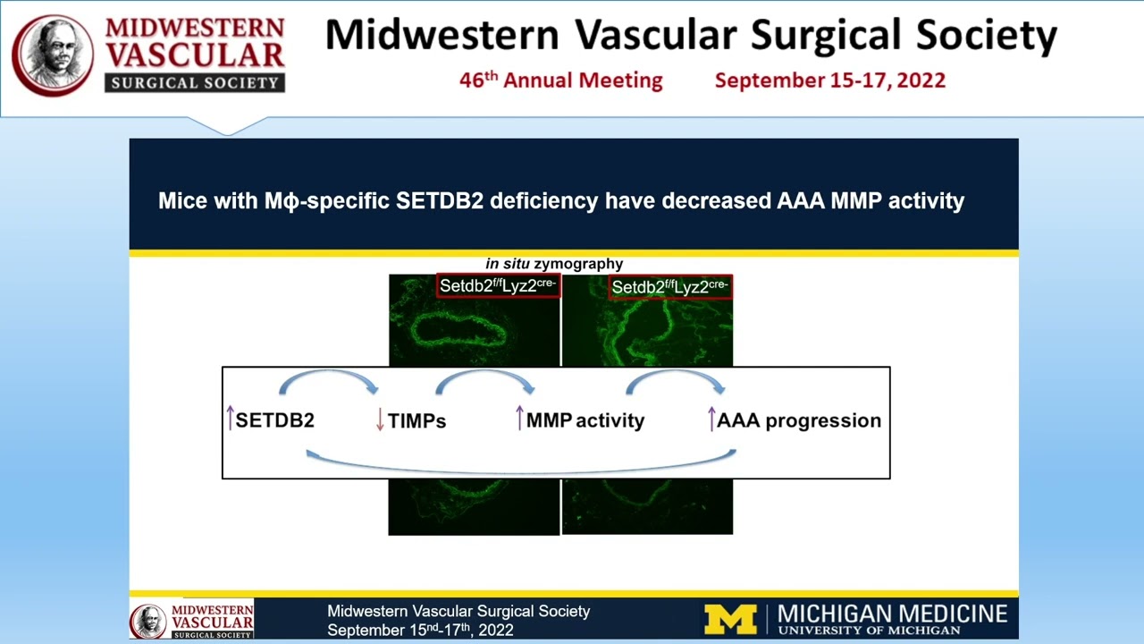 IFNB Regulates AAA Formation by Modulating Expression of the Histone ...