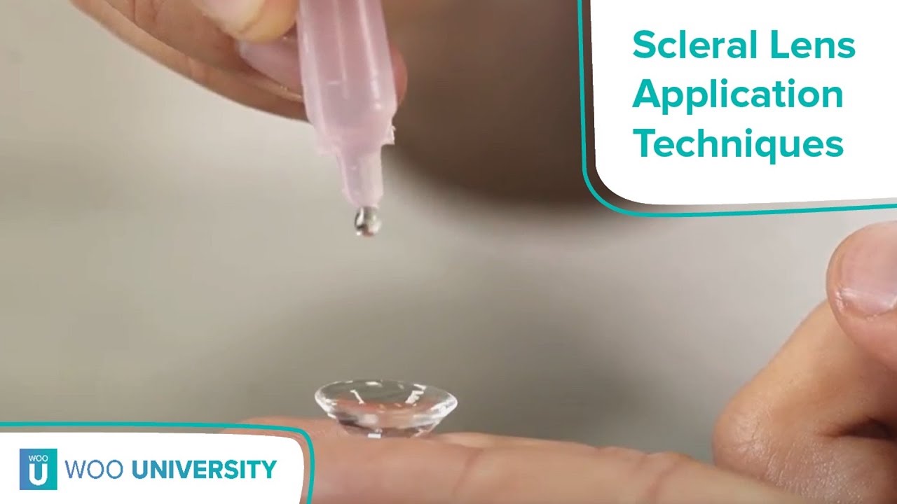 Scleral Lens Application Techniques - YouTube