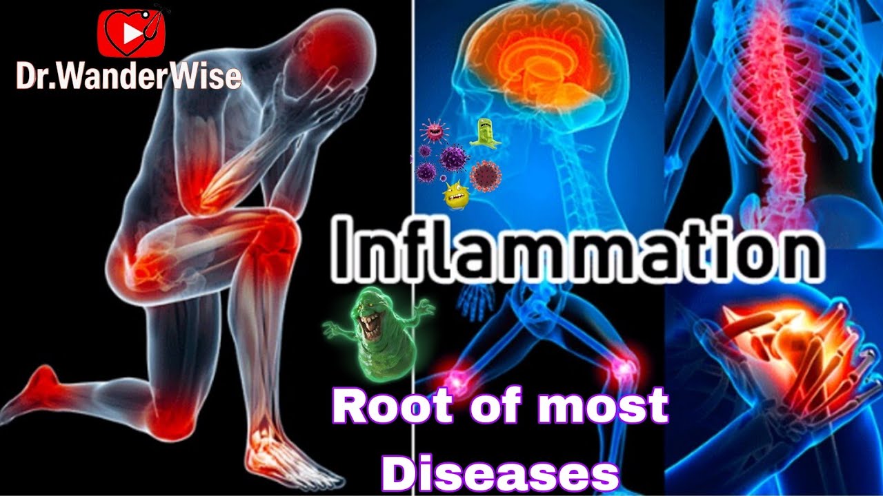 What is inflammation ? || How it works ? | Types of Inflammations and ...