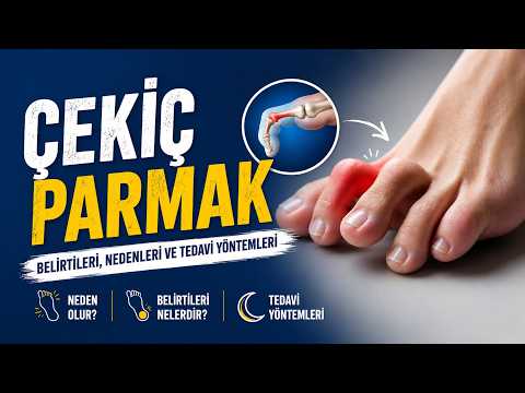 Çekiç Parmak: Belirtileri, Nedenleri ve Tedavi Yöntemleri | Prof. Dr. Yakup YILDIRIM