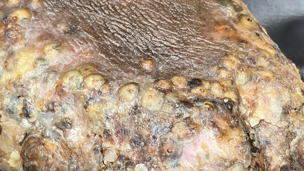 Timina's Very Last Jigger Dig #1 - see long videos @ riseupsociety.net ...