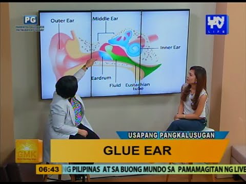 Good Morning Kuya: That sticky gunk could be Glue Ear (luga) - YouTube