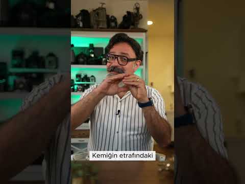 #çatlak #kırık #ortopedi #travmatoloji