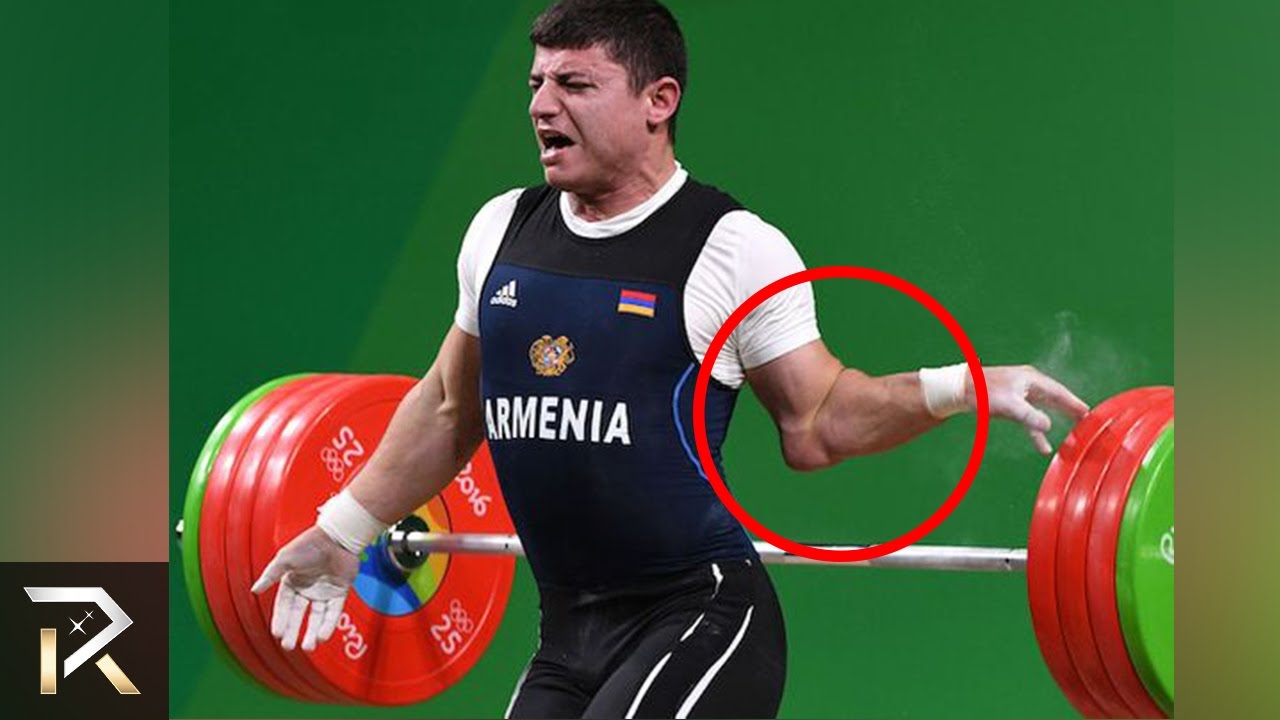 10 Painful Sports Injuries Caught On Camera - YouTube