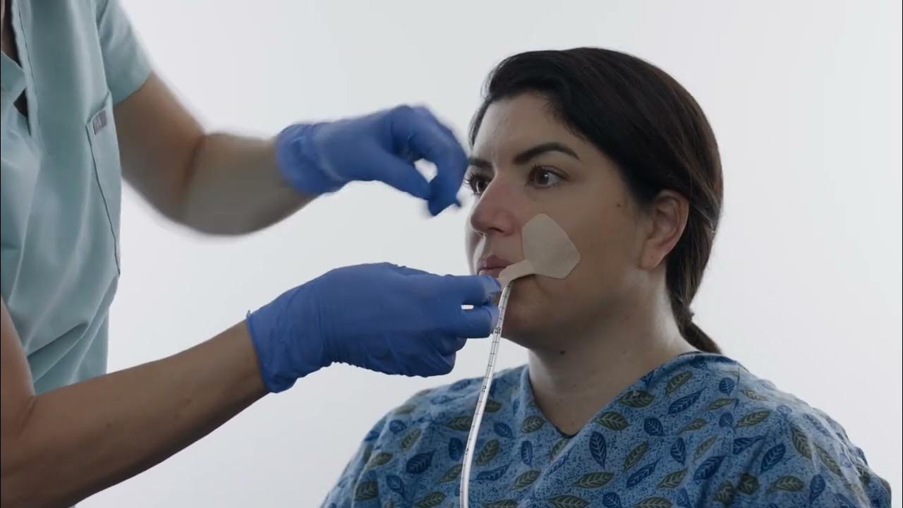 Mise en place - Fixation pour sonde naso-gastrique UltraGrip™ par voie orale - YouTube