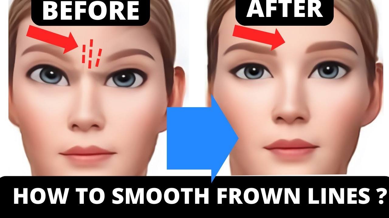 Naturally Reduce Wrinkles Between Eyebrows! Smooth Frown Lines ...