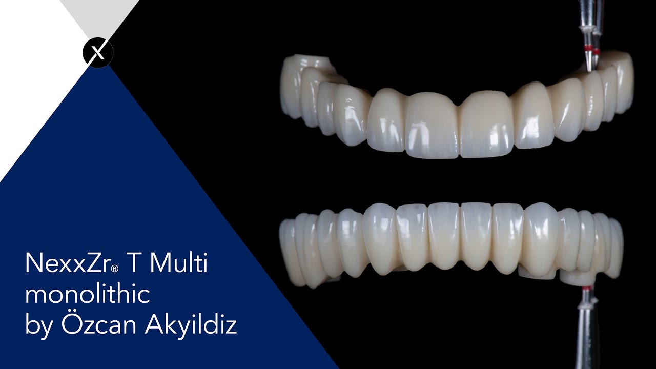 Sagemax experience: NexxZr T Multi monolithic by Özcan Akyildiz - YouTube