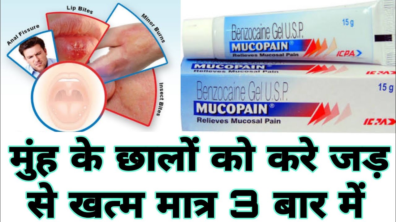 MUCOPAIN GEL REVIEW IN HINDI // HOW TO USE OF MUCOPAIN GEL CREAM - YouTube
