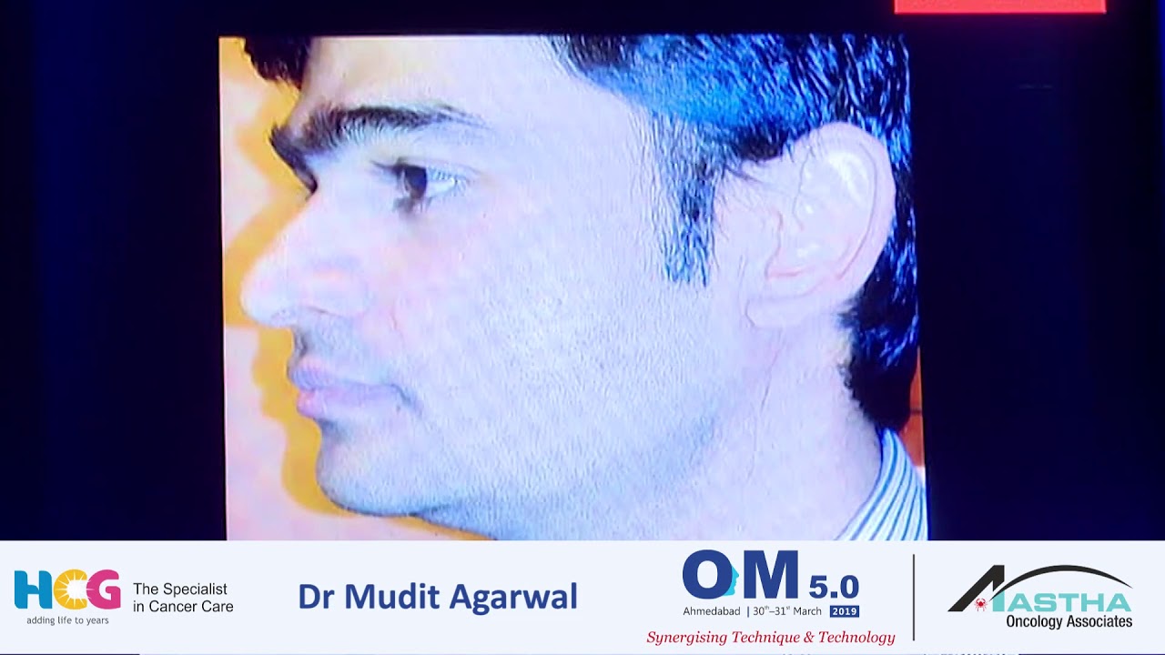 Superficial Parotidectomy Dr Mudit Agarwal - YouTube