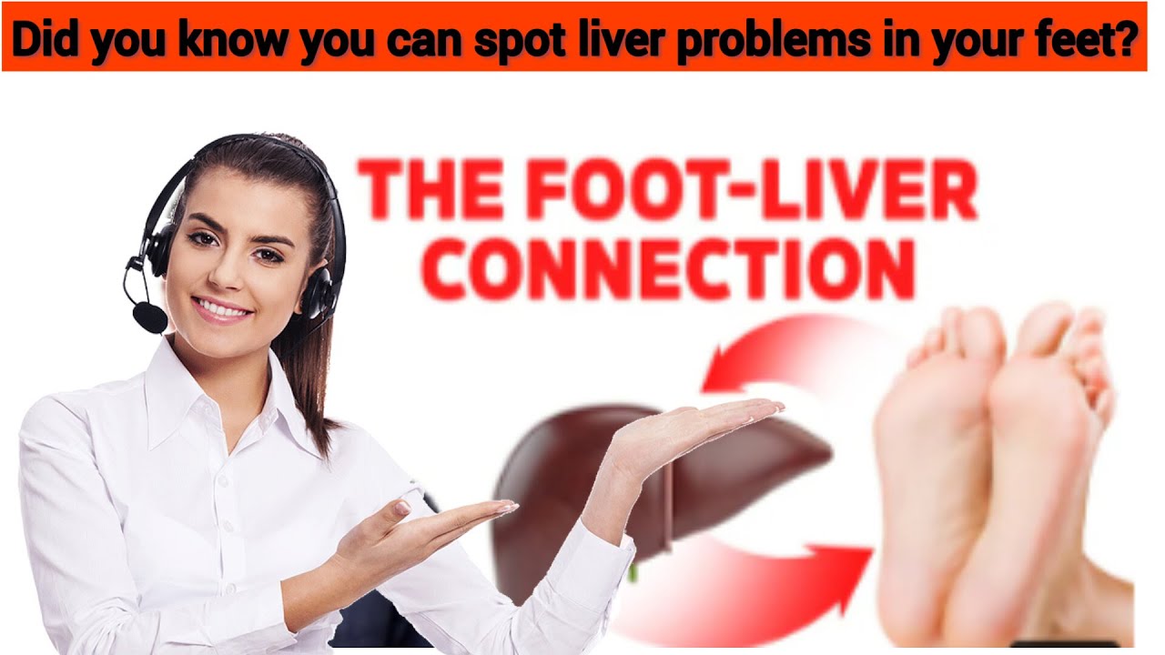 9 Things Your Feet Can Tell You About Your Liver Problems - YouTube