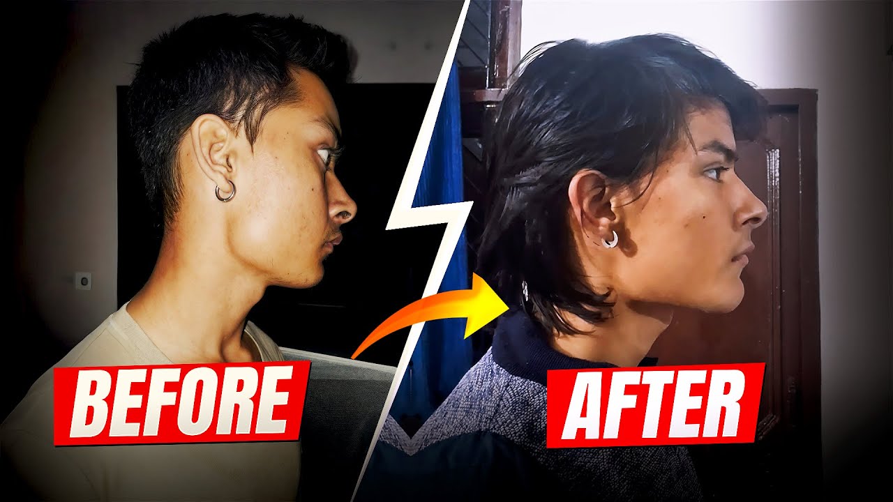 Fix Your Recessed Chin in 30 Days, The Ultimate Sharp Jawline Blueprint ...