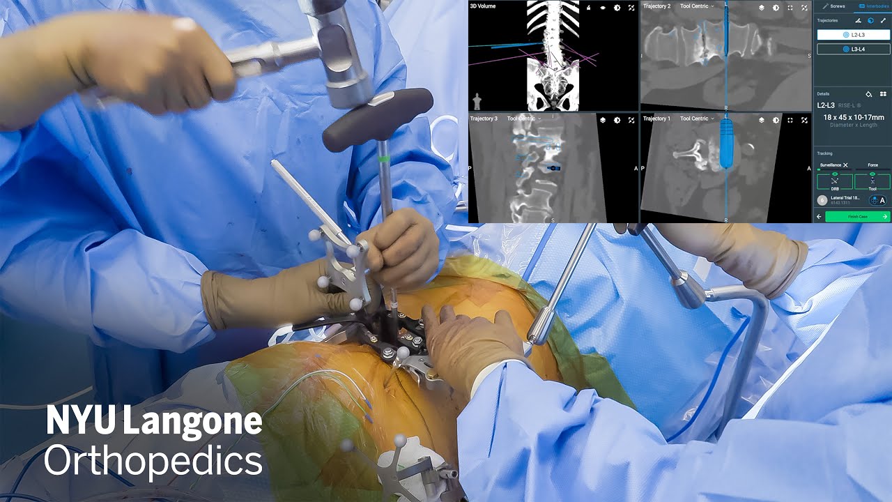 Single Position Spine Surgery: ALIF, LLIF & Posterior Instrumentation ...