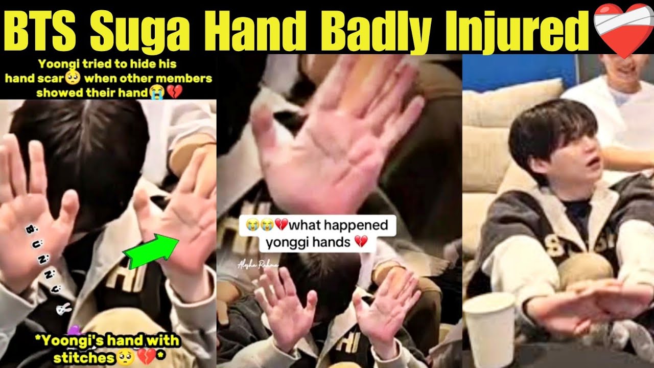 BTS Suga Hand Badly Injured ️‍🩹 Cut in Yoongi Hand 💔 BTS Suga Hand ...