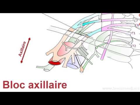 Bloc axillaire échoguidé BAX - YouTube