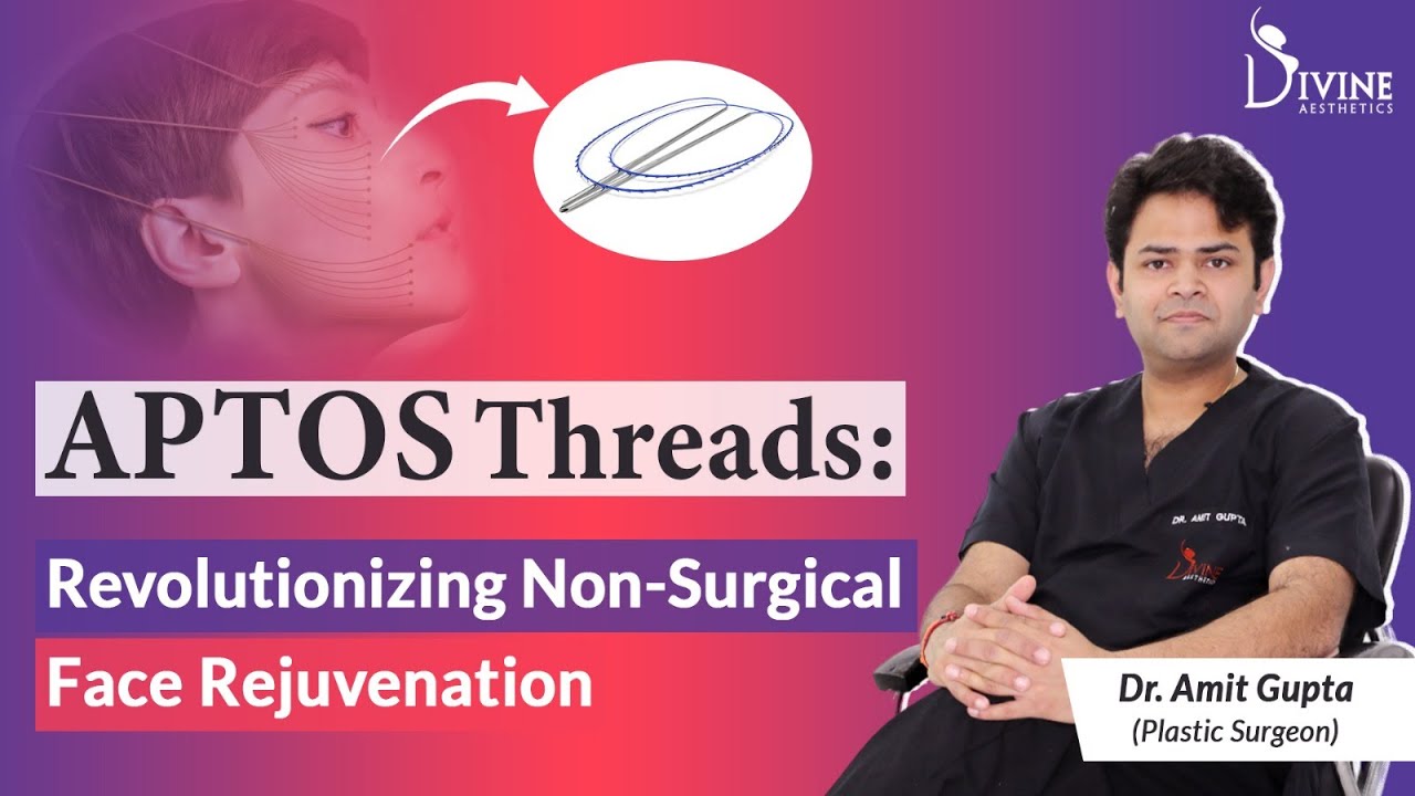 How APTOS threads are changing the non-surgical face rejuvenation ...